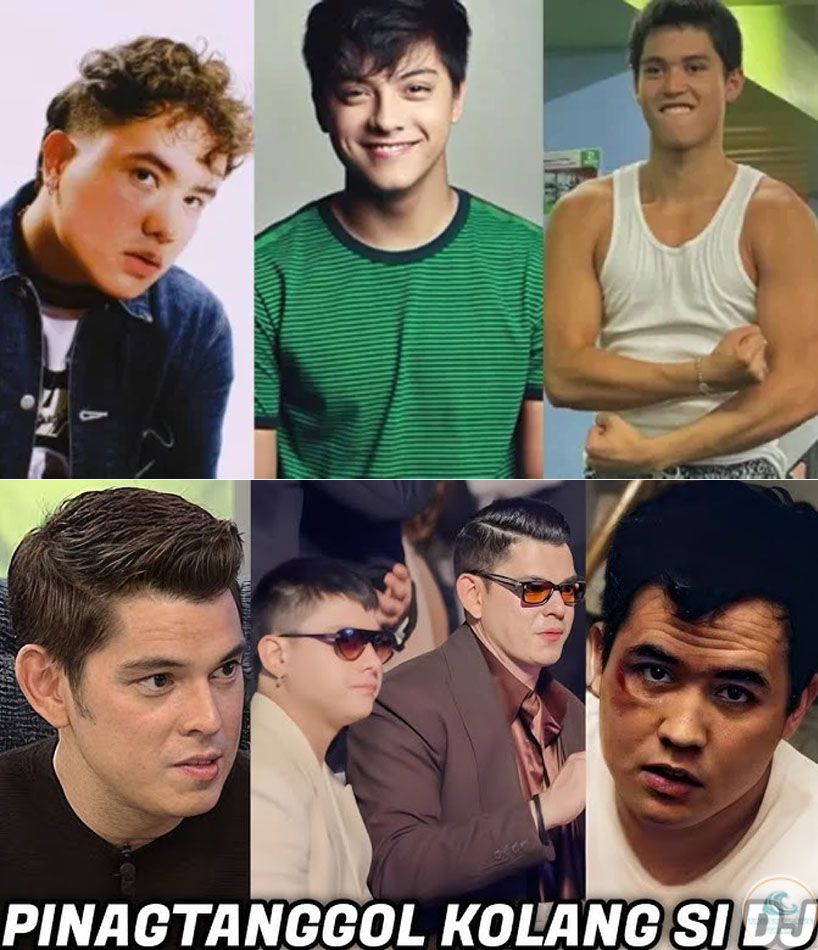 JK Labajo BASAG ang MUKHA ng SAPAKIN ni Richard Gutierrez dahil sa ...