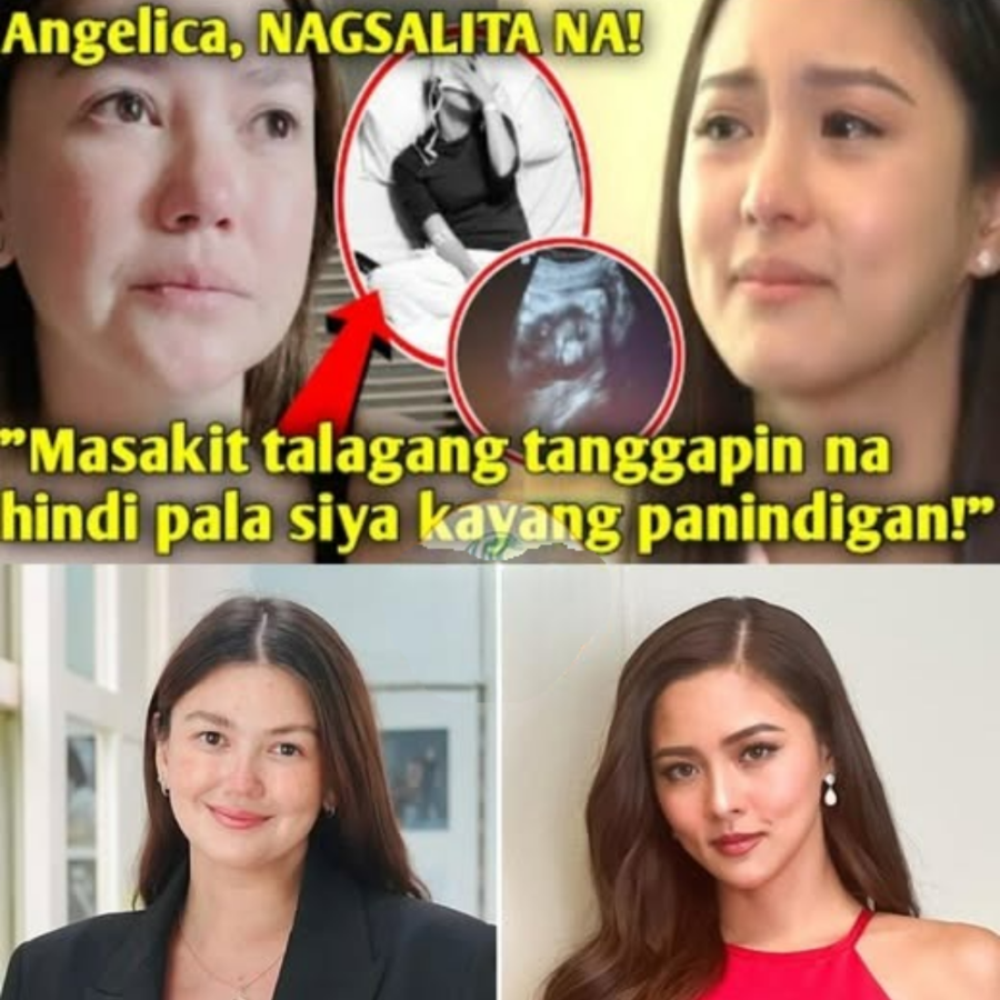 Angelica Panganiban Breaks Her Silence: The “Secret” Behind Kim Chiu and Xian Lim’s Breakup ...
