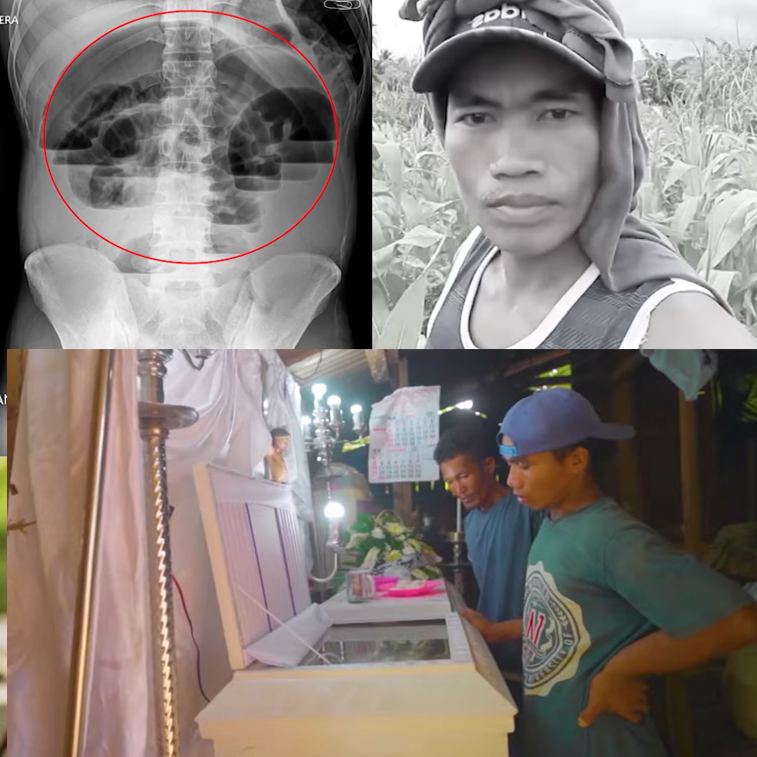 ₱20,000 Mukbang Challenge or Medical Crisis? Uncovering the Death of a ...