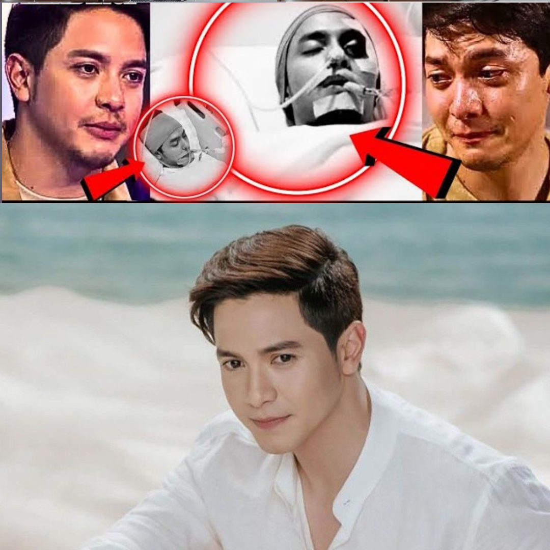 What Really Happened? Alden Richards Stuns Fans with Unexpected ...