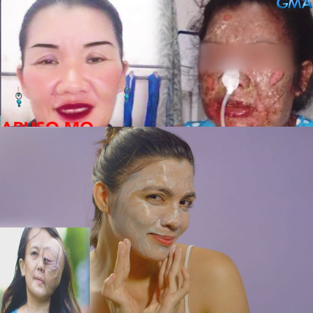 Tragedy Behind Beauty: The Skin-Care Routine That Turned Deadly - News