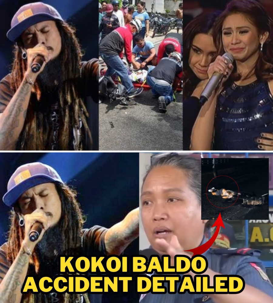 What happened to Kokoi Baldo? Accident injuries explored as 'The Voice' Philippines star - News